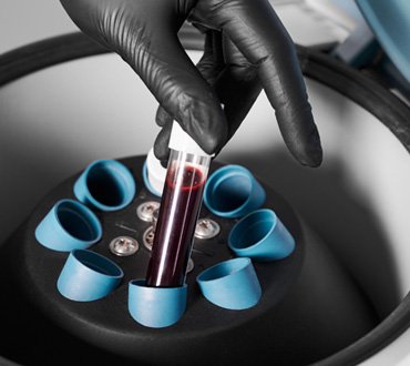 Hormonal Assay – labozitoune